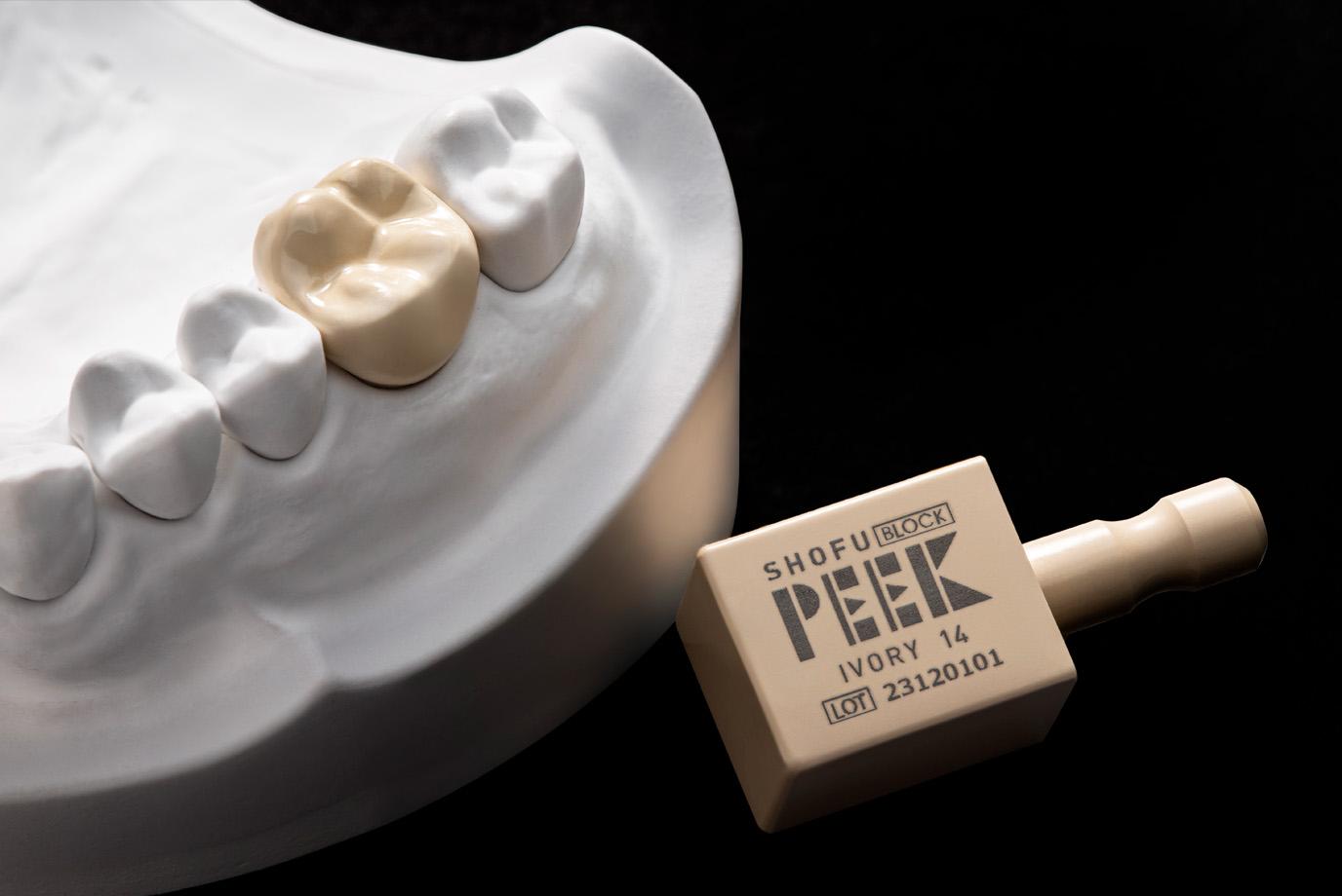 【PEEK冠】保険の白い歯がすべての部位に使える？｜中野の歯医者 | マナミ歯科クリニック